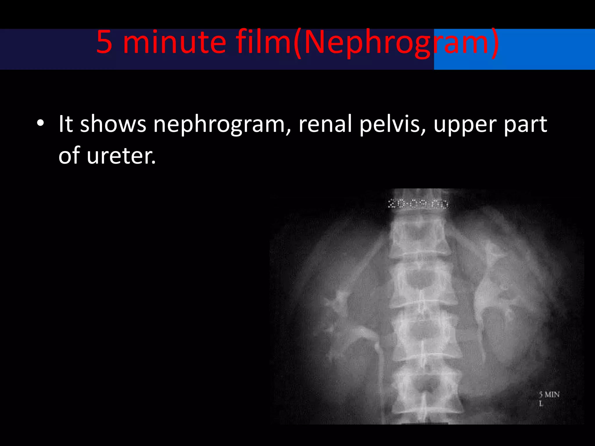 IVP, RGU & MCU | PPTX | Digestive Disorders | Diseases and Conditions