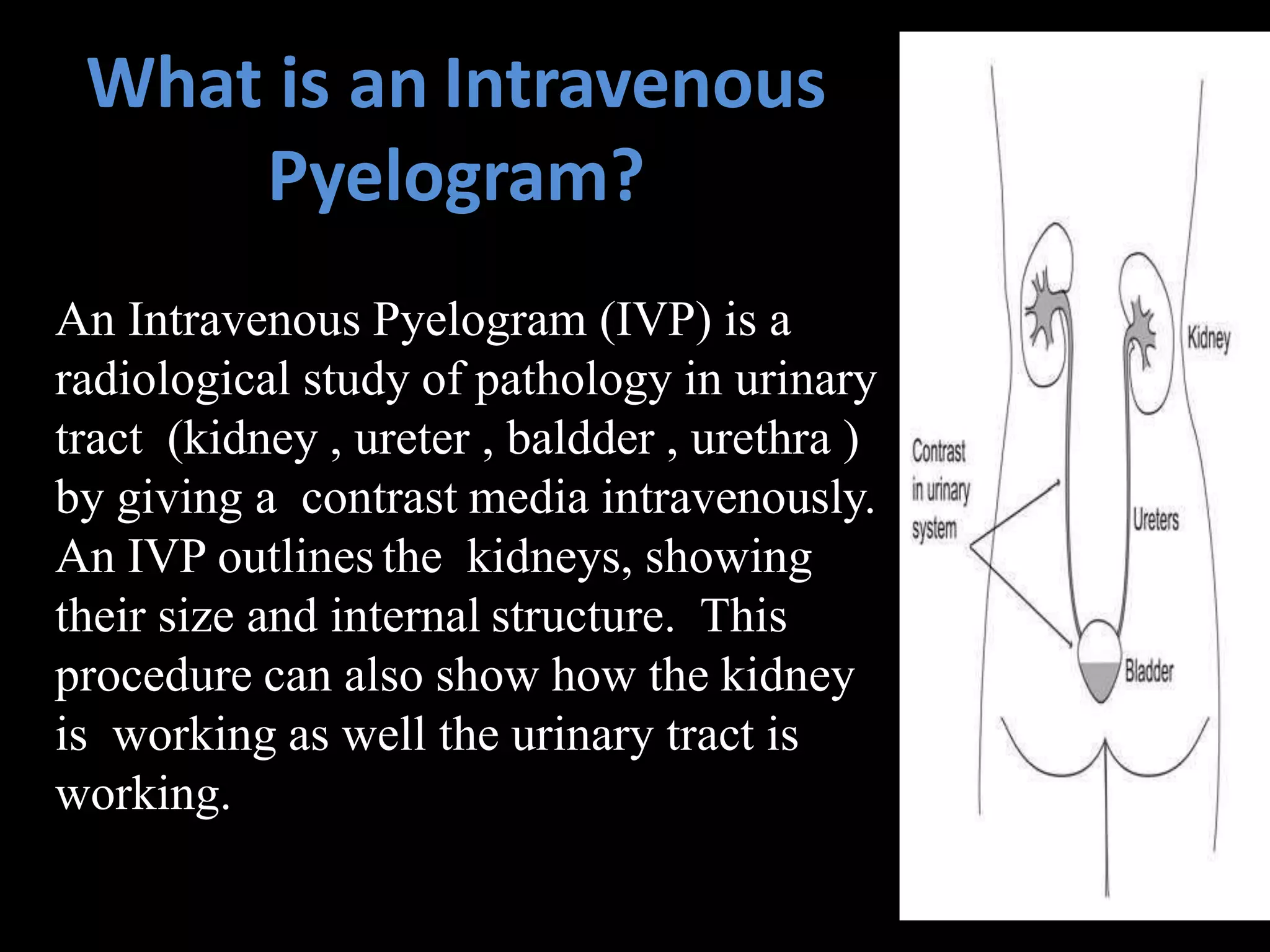IVP, RGU & MCU | PPTX