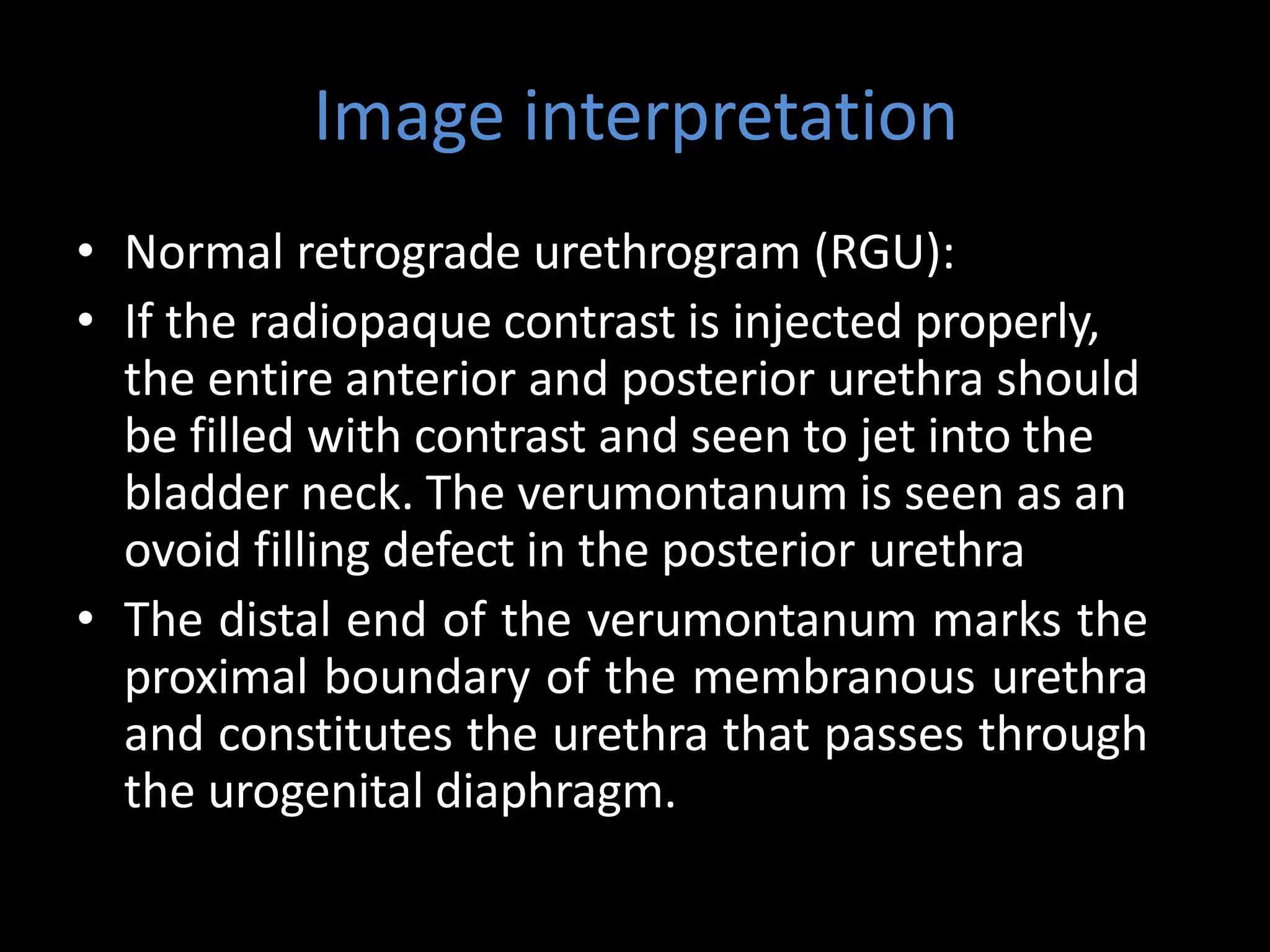 IVP, RGU & MCU | PPTX