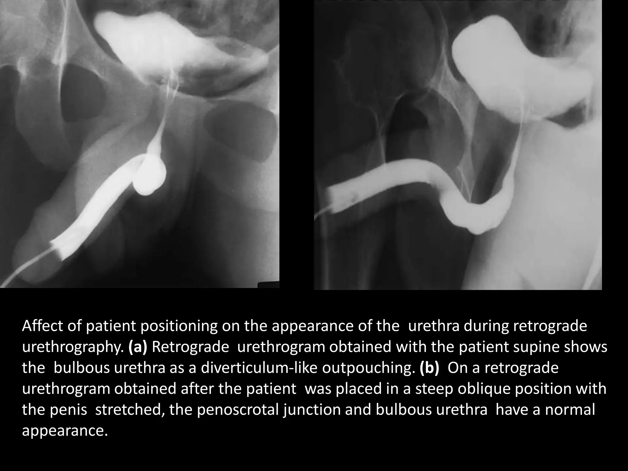 IVP, RGU & MCU | PPTX