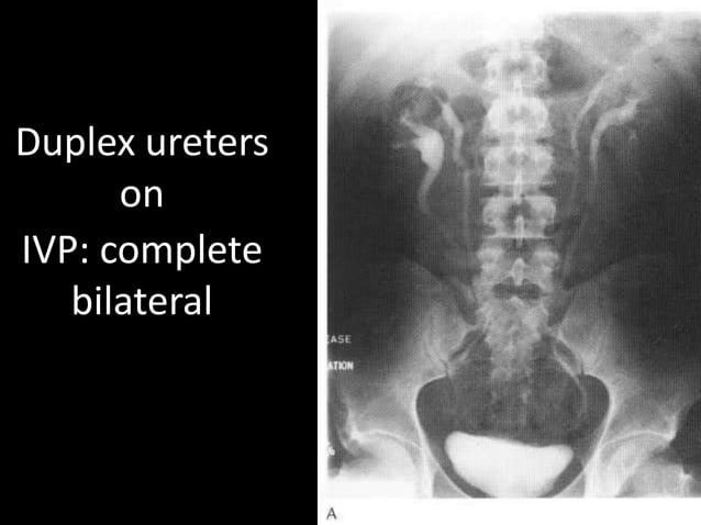 IVP, RGU & MCU | PPTX | Digestive Disorders | Diseases and Conditions