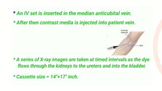 IVP (Intravenous Pyelography): An Overview of the Urinary System | PDF