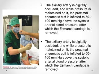 Presentation on intravenous regional anaesthesia | PPTX