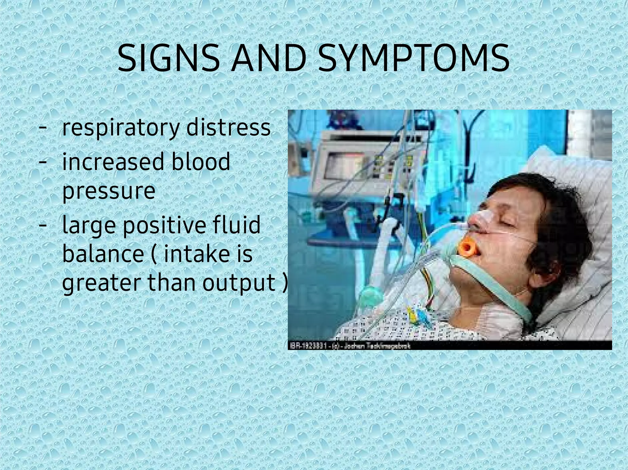 IVT COMPLICATIONS & MANAGEMENT(1).pdf