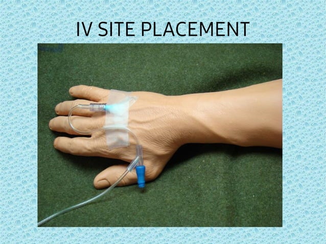 IVT COMPLICATIONS & MANAGEMENT(1).pdf | First Aid | Injuries
