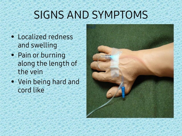 IVT COMPLICATIONS & MANAGEMENT(1).pdf | First Aid | Injuries
