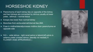 INTRAVENOUS UROGRAM ( IVU ) | PPTX