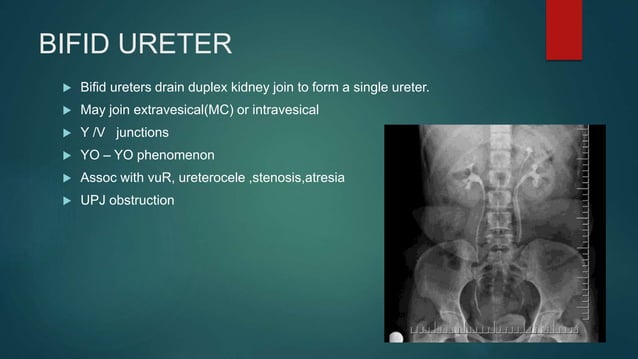 INTRAVENOUS UROGRAM ( IVU ) | PPTX