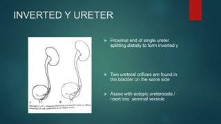 INTRAVENOUS UROGRAM ( IVU ) | PPTX