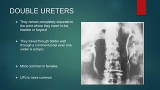 INTRAVENOUS UROGRAM ( IVU ) | PPTX