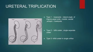 INTRAVENOUS UROGRAM ( IVU ) | PPTX
