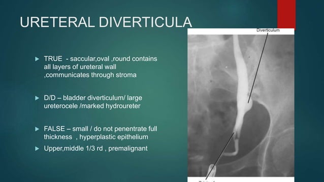 INTRAVENOUS UROGRAM ( IVU ) | PPTX
