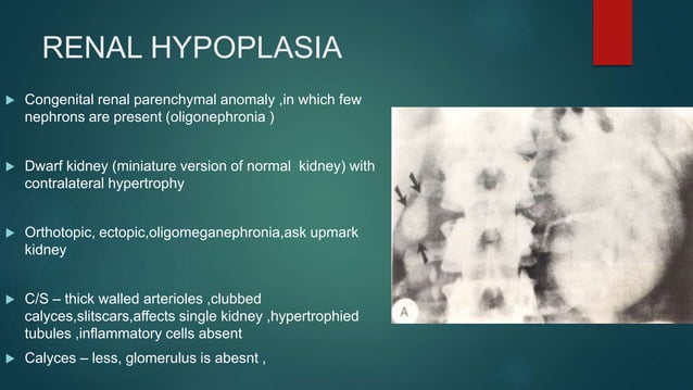 INTRAVENOUS UROGRAM ( IVU ) | PPTX