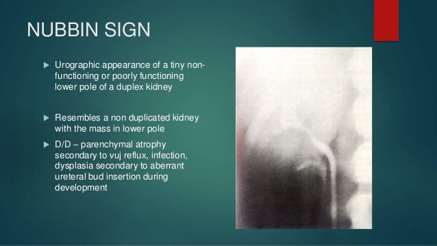 INTRAVENOUS UROGRAM ( IVU )