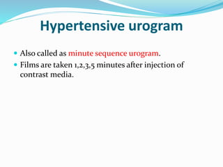 Intravenous urography | PPT