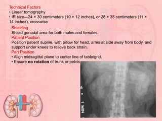 IVU lecture .....ppt | Medical Tests | Medical Health