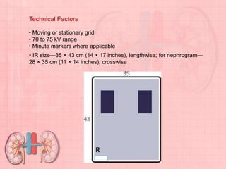 IVU lecture .....ppt | Medical Tests | Medical Health