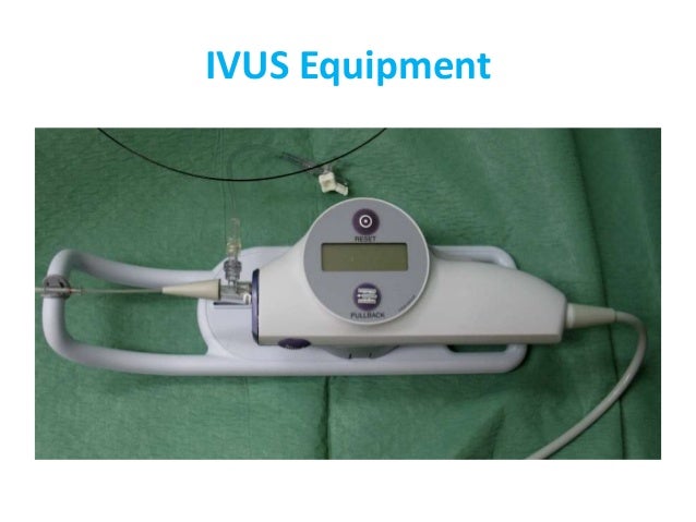 Ivus