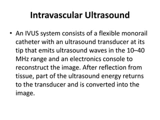 IVUS | PPTX