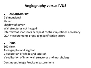 IVUS | PPT