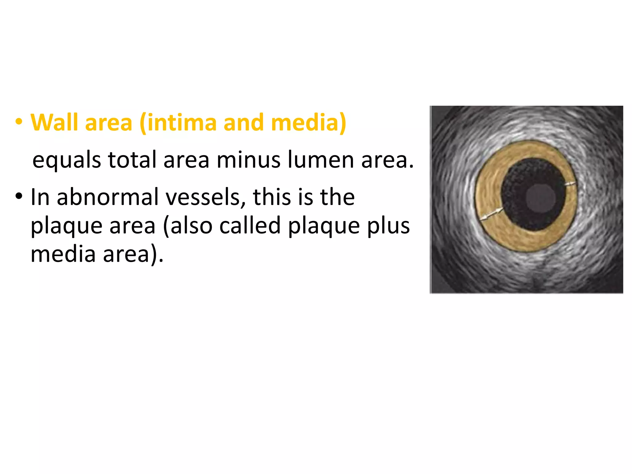 Intravascular Ultrasound (IVUS) | PPTX