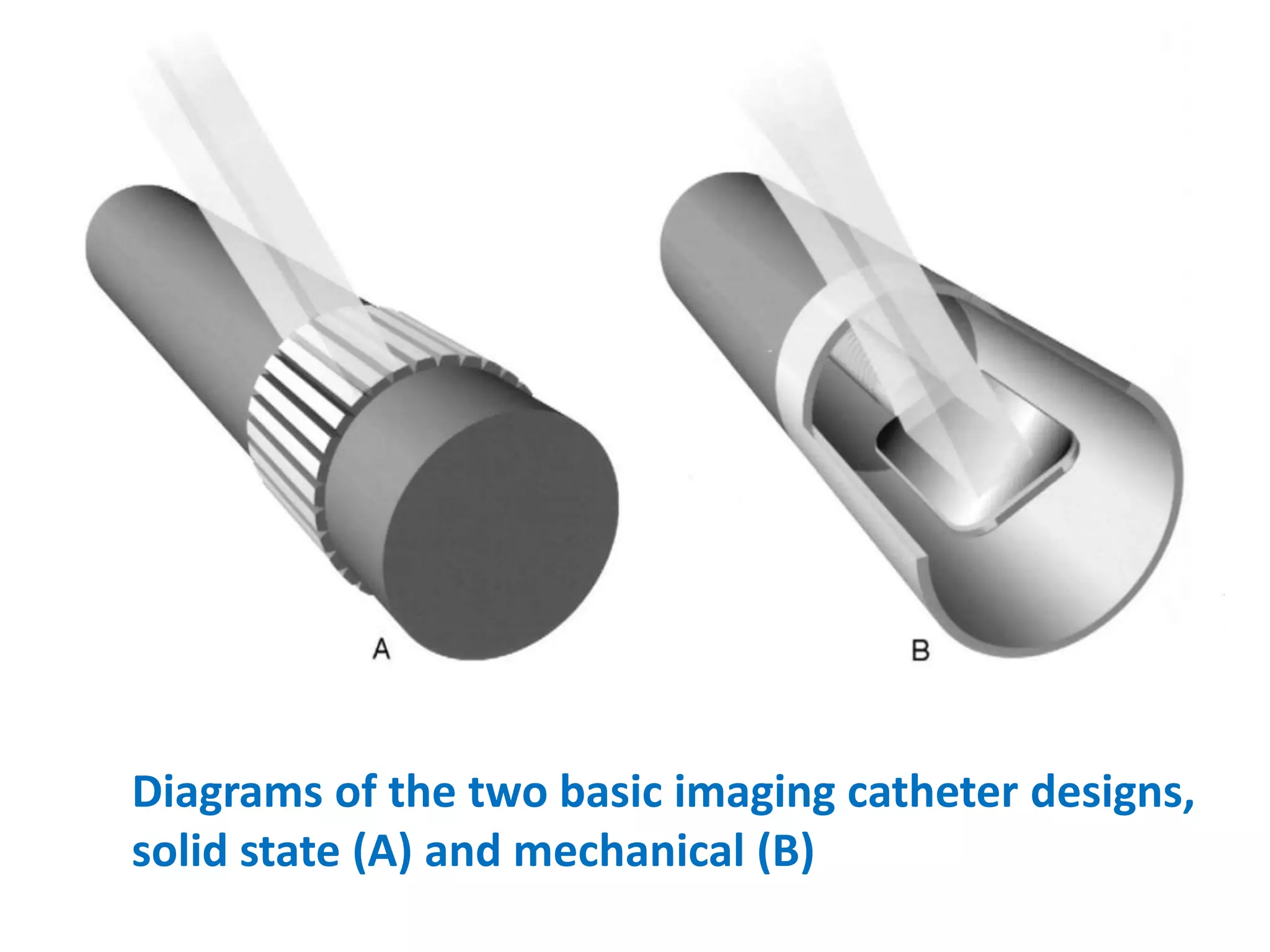 Intravascular Ultrasound (IVUS) | PPTX