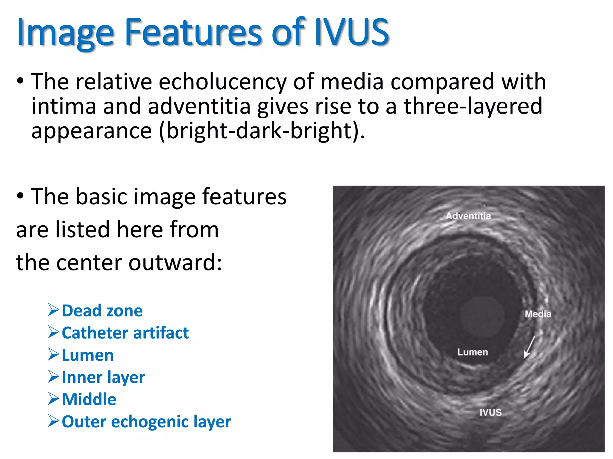 Intravascular Ultrasound (IVUS) | PPTX