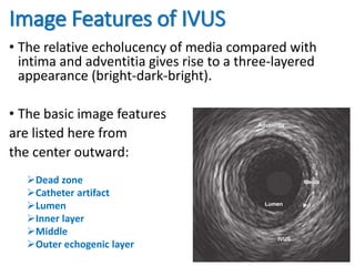 Intravascular Ultrasound (IVUS) | PPTX