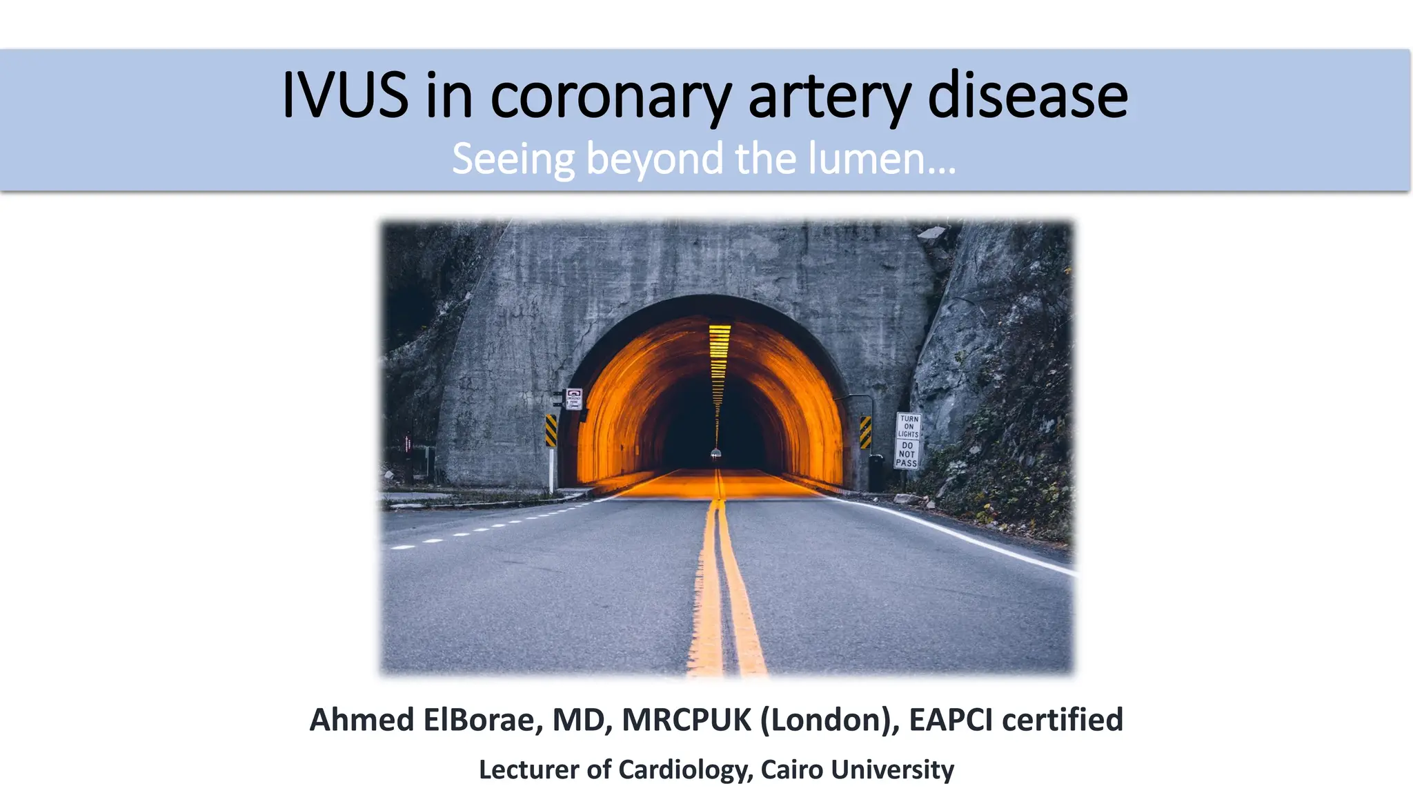 IVUS Intravascular ultrasound made easy for intervention cardiologist | PDF