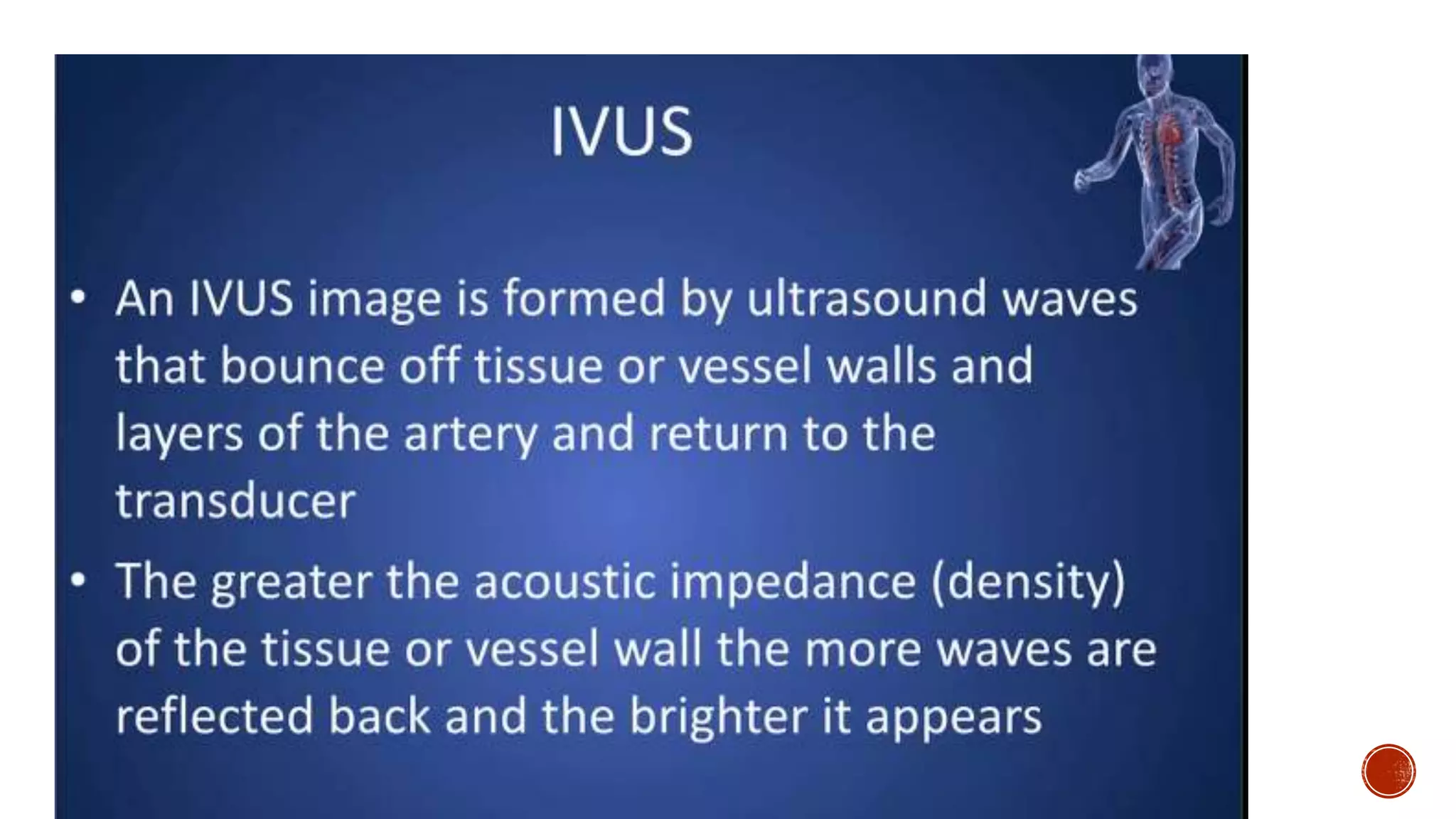 Ivus jc ultimate trial | PPTX