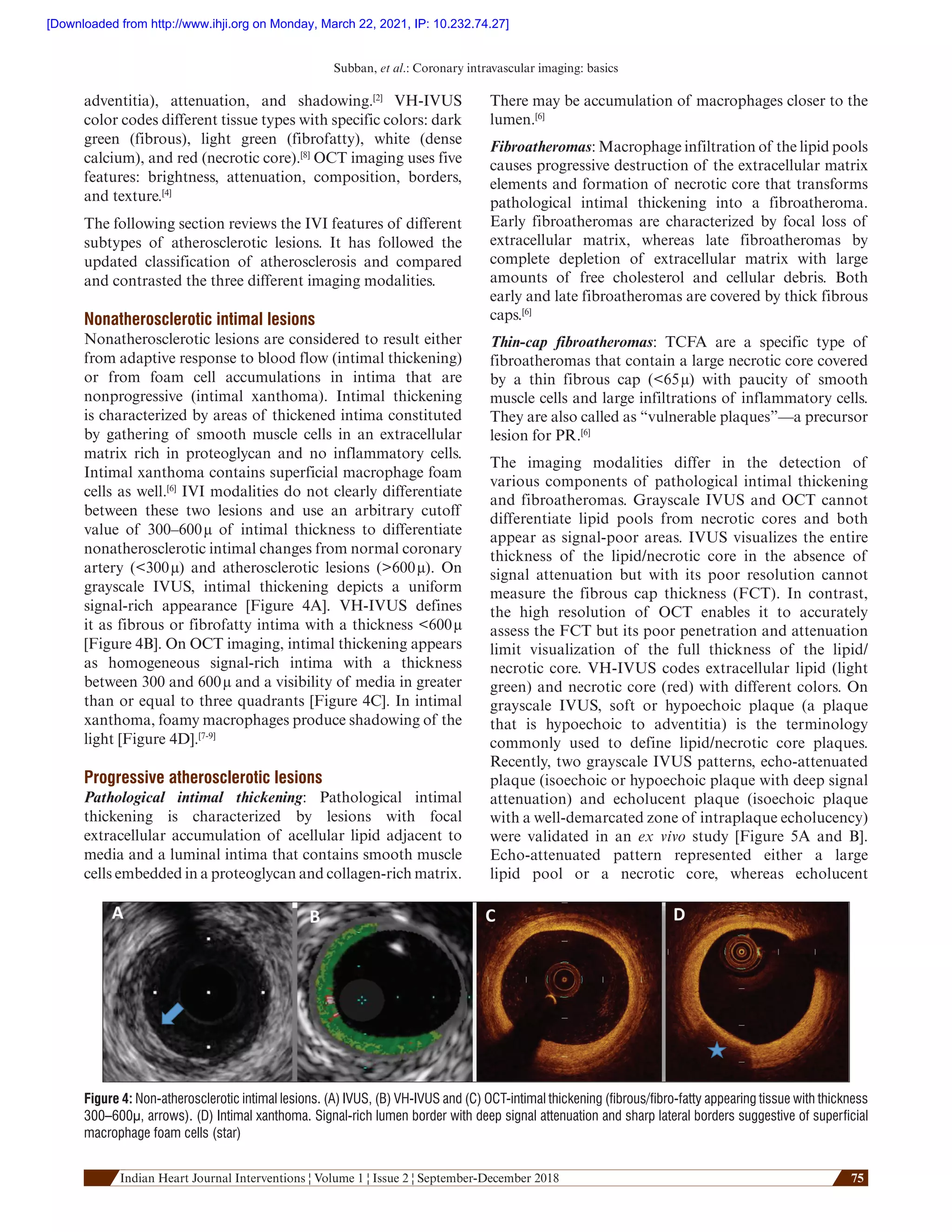Ivus oct | PDF | Heart and Cardiovascular Diseases | Diseases and ...