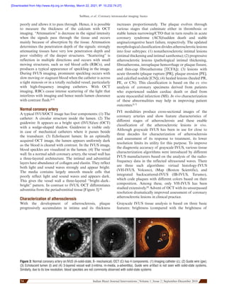 Ivus oct | PDF