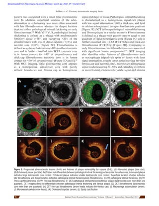 Ivus oct | PDF