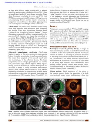 Ivus oct | PDF