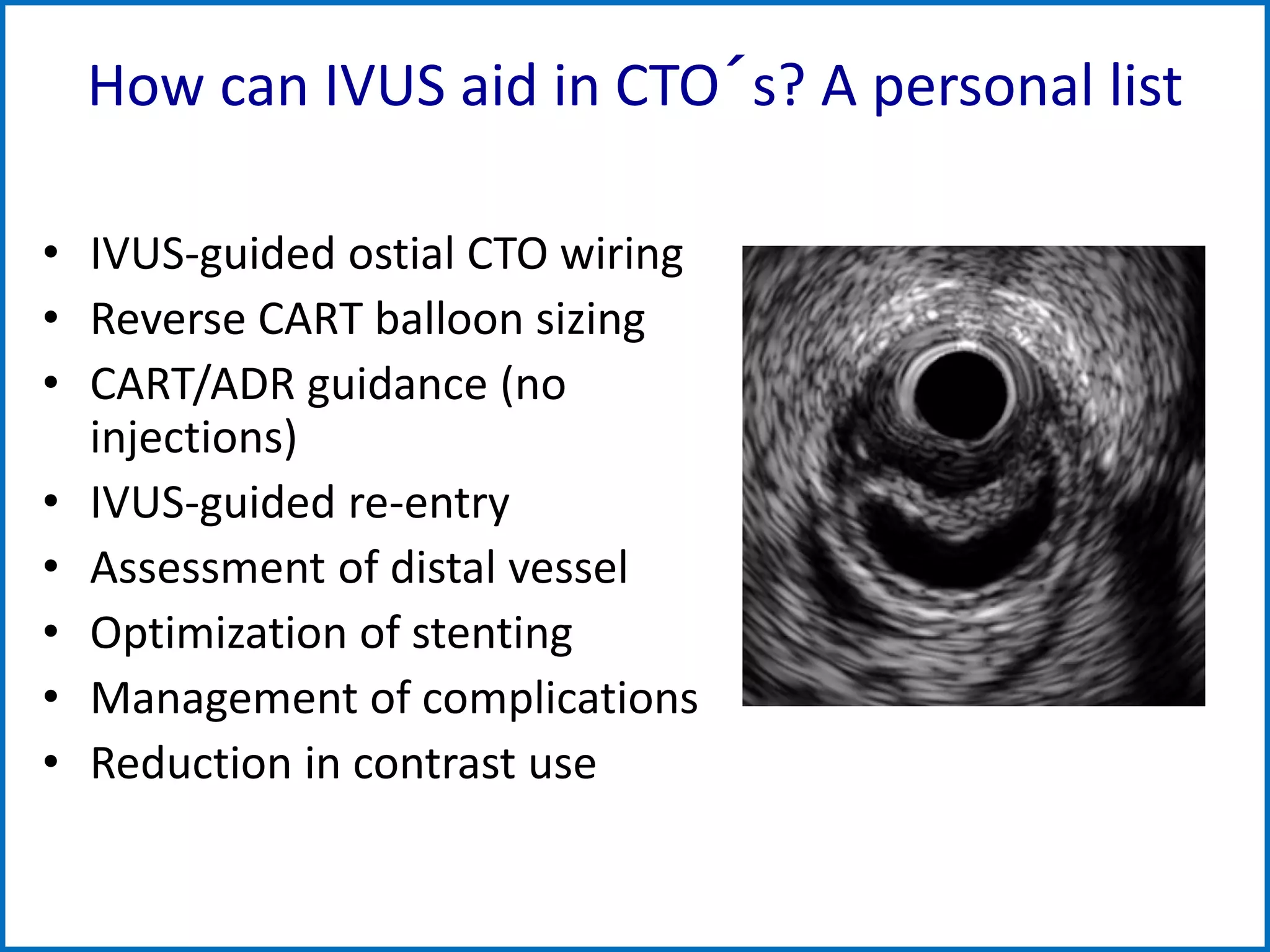 Philip Dingli. Javier Escaned - Intracoronary imaging in CTOs When to ...
