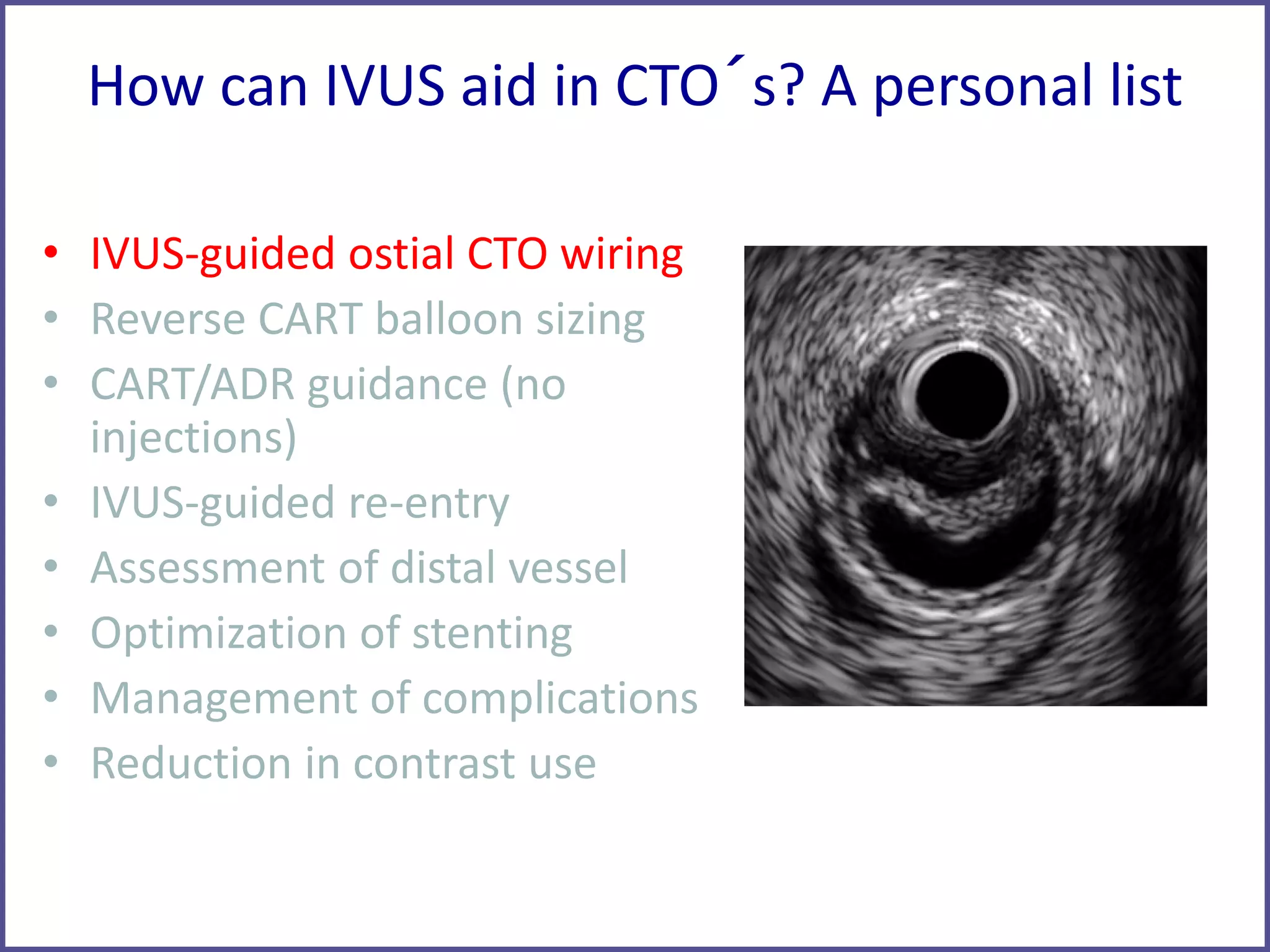 Philip Dingli. Javier Escaned - Intracoronary imaging in CTOs When to ...