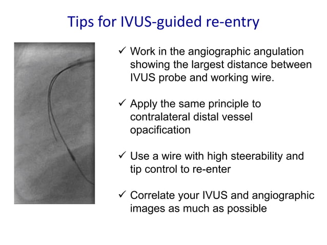 Philip Dingli. Javier Escaned - Intracoronary imaging in CTOs When to ...