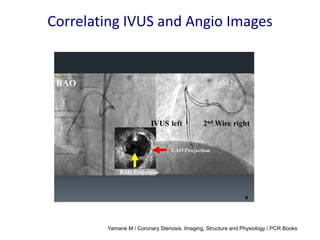 Philip Dingli. Javier Escaned - Intracoronary imaging in CTOs When to ...