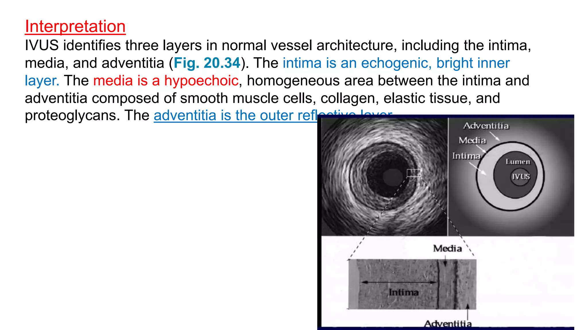 IVUS OCT BRAUNWALD.pptx