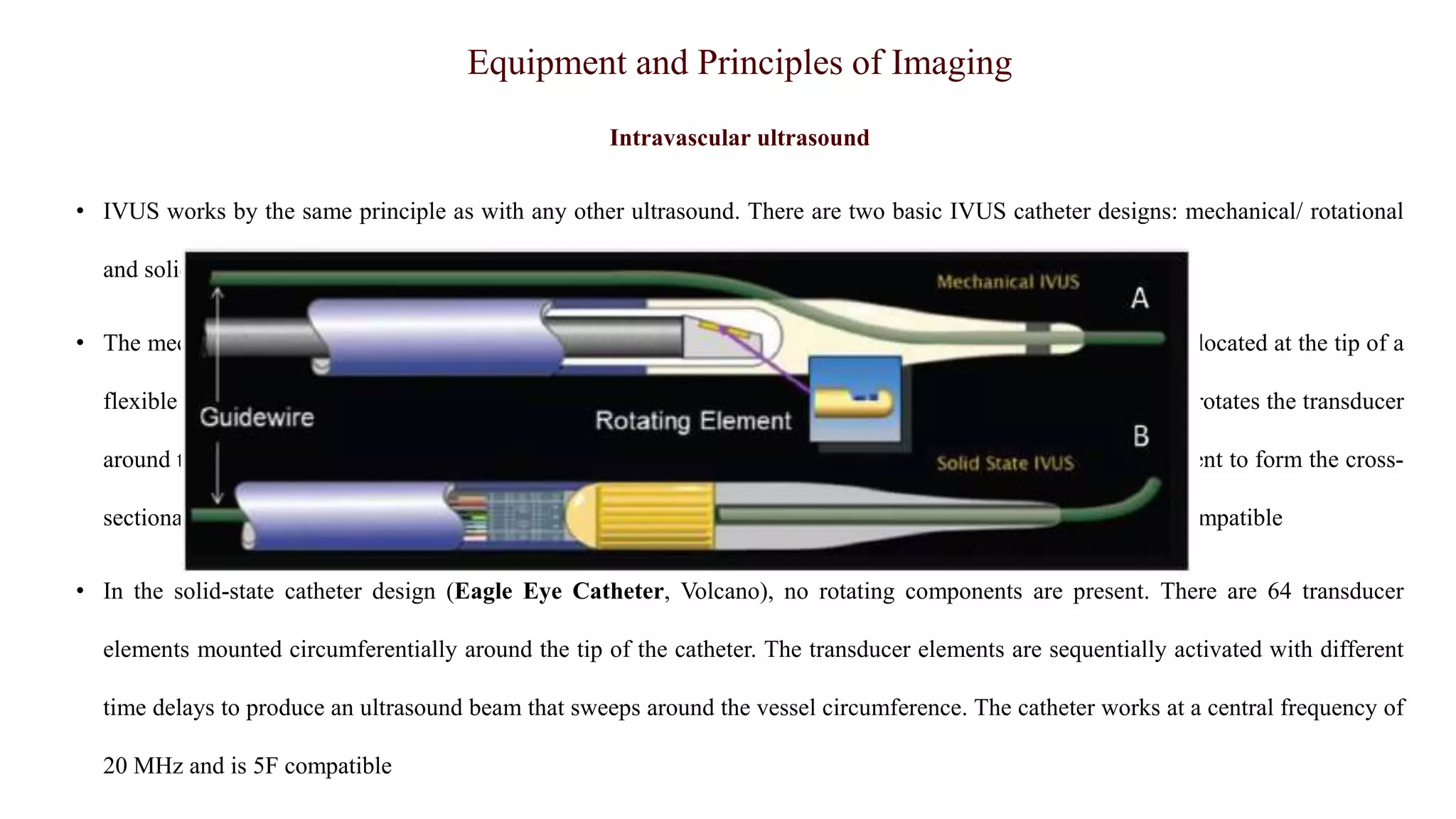 IVUS v/s OCT for Coronary Revascularization | PPTX