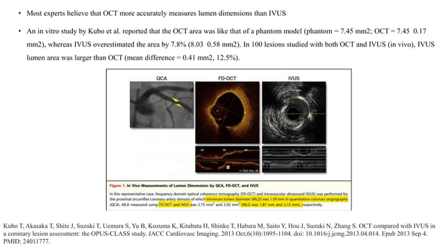 IVUS v/s OCT for Coronary Revascularization | PPTX
