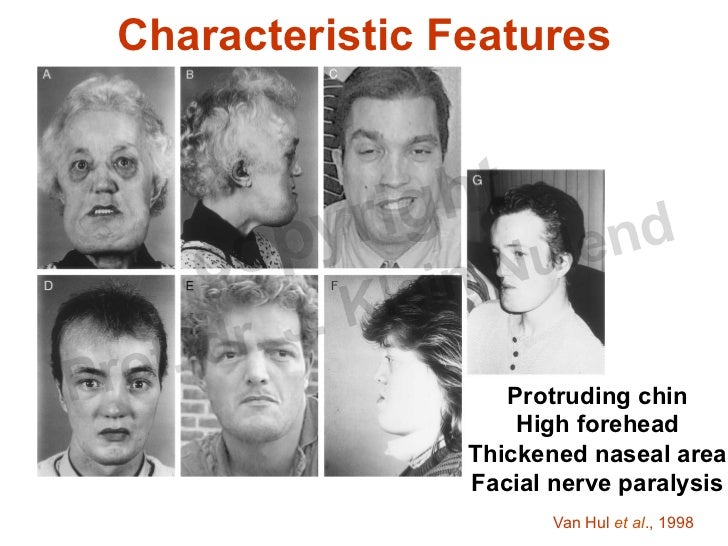 Inbreeding In Humans