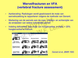Hoe wervelfracturen te diagnosticeren | PPT