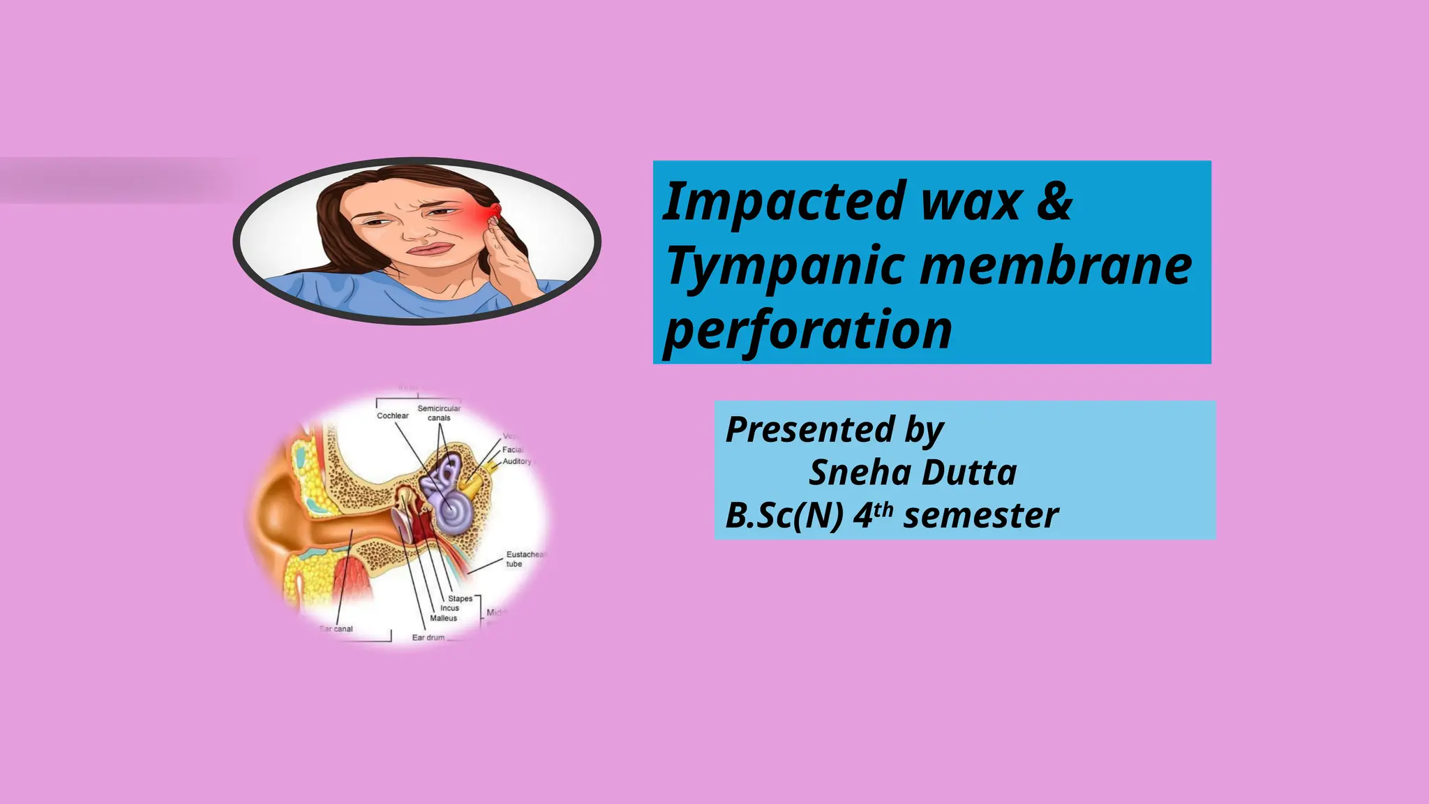 Cerumen impaction &Tympanic membrane perforation.pptx