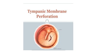 Cerumen impaction &Tympanic membrane perforation.pptx