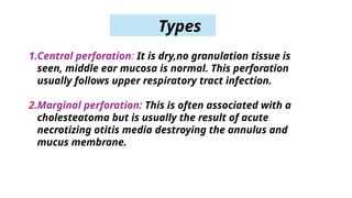 Cerumen impaction &Tympanic membrane perforation.pptx