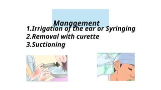 Cerumen impaction &Tympanic membrane perforation.pptx