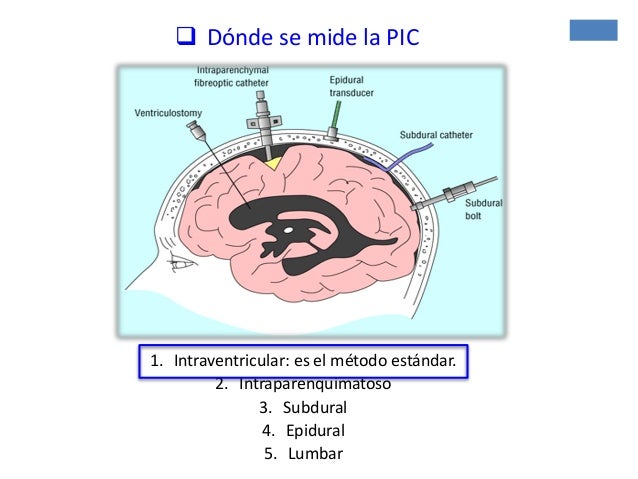 Ix.1. neuromonitorizacion