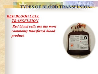 Blood transfusion bmfjhdghdggffjjkh,hjh,h | PDF