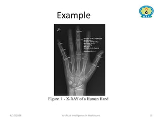 Artificial intelligence in Health Care | PPTX